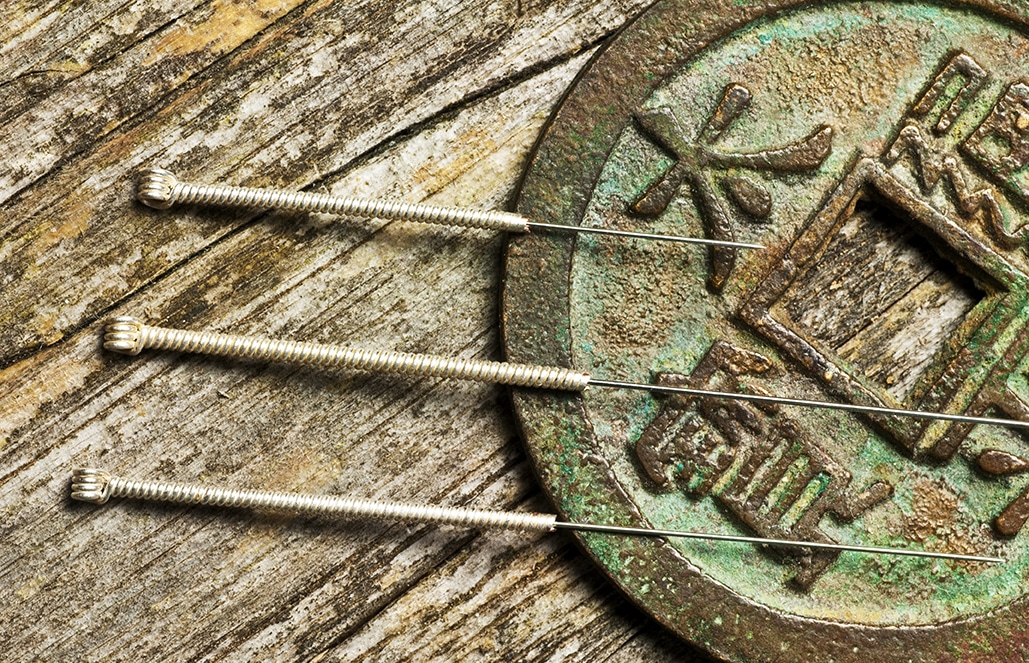 Medicina Tradicional Chinesa: Acupuntura