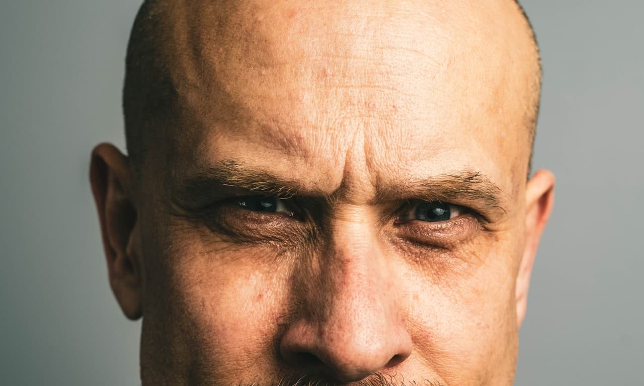 Linguagem do corpo: entenda o que pode levar à calvície